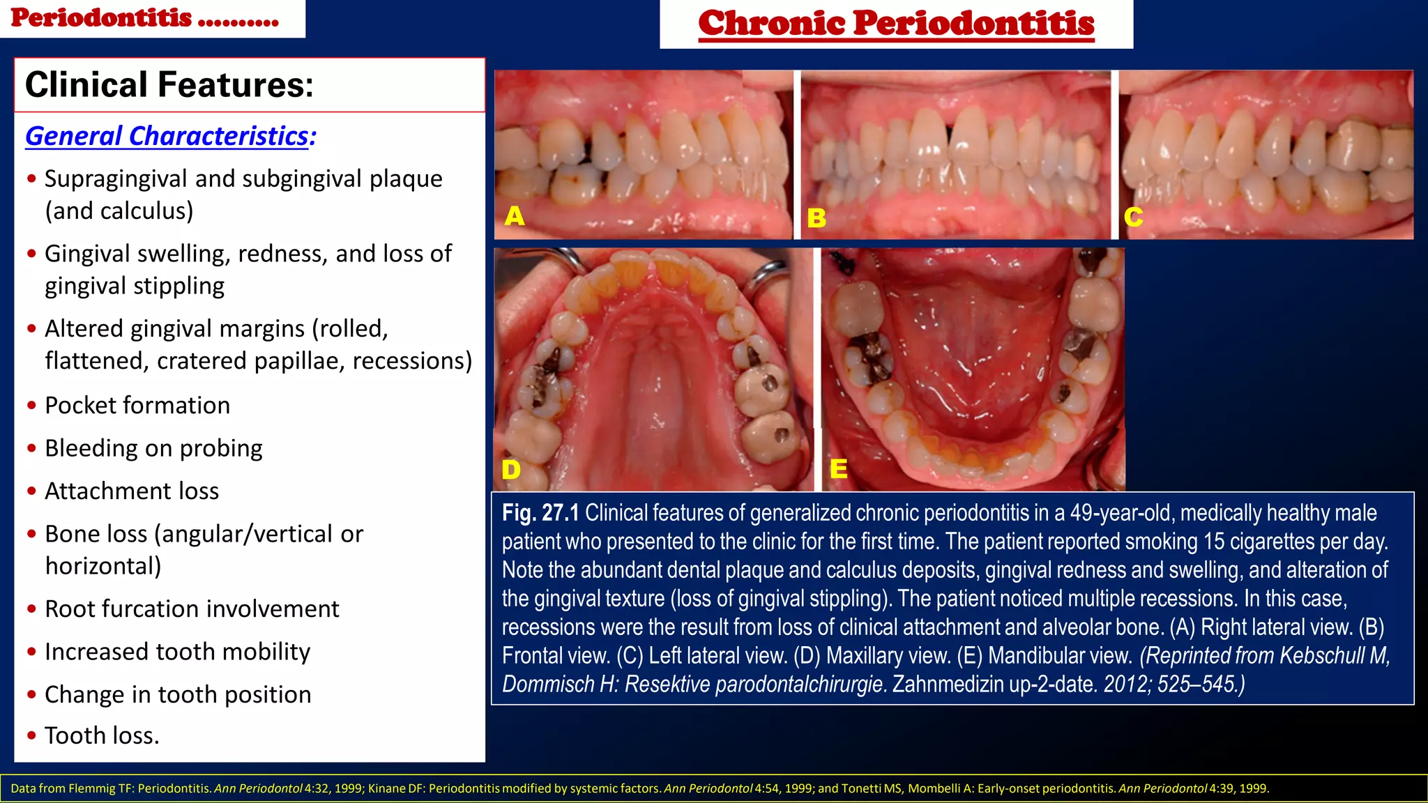 Periodontal diseases Classifications and treatments | PDF