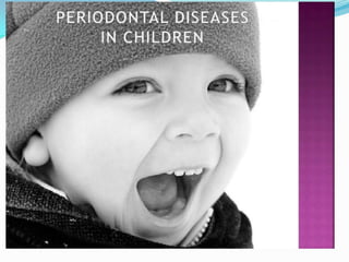 Periodontal diseases in children | PPTX
