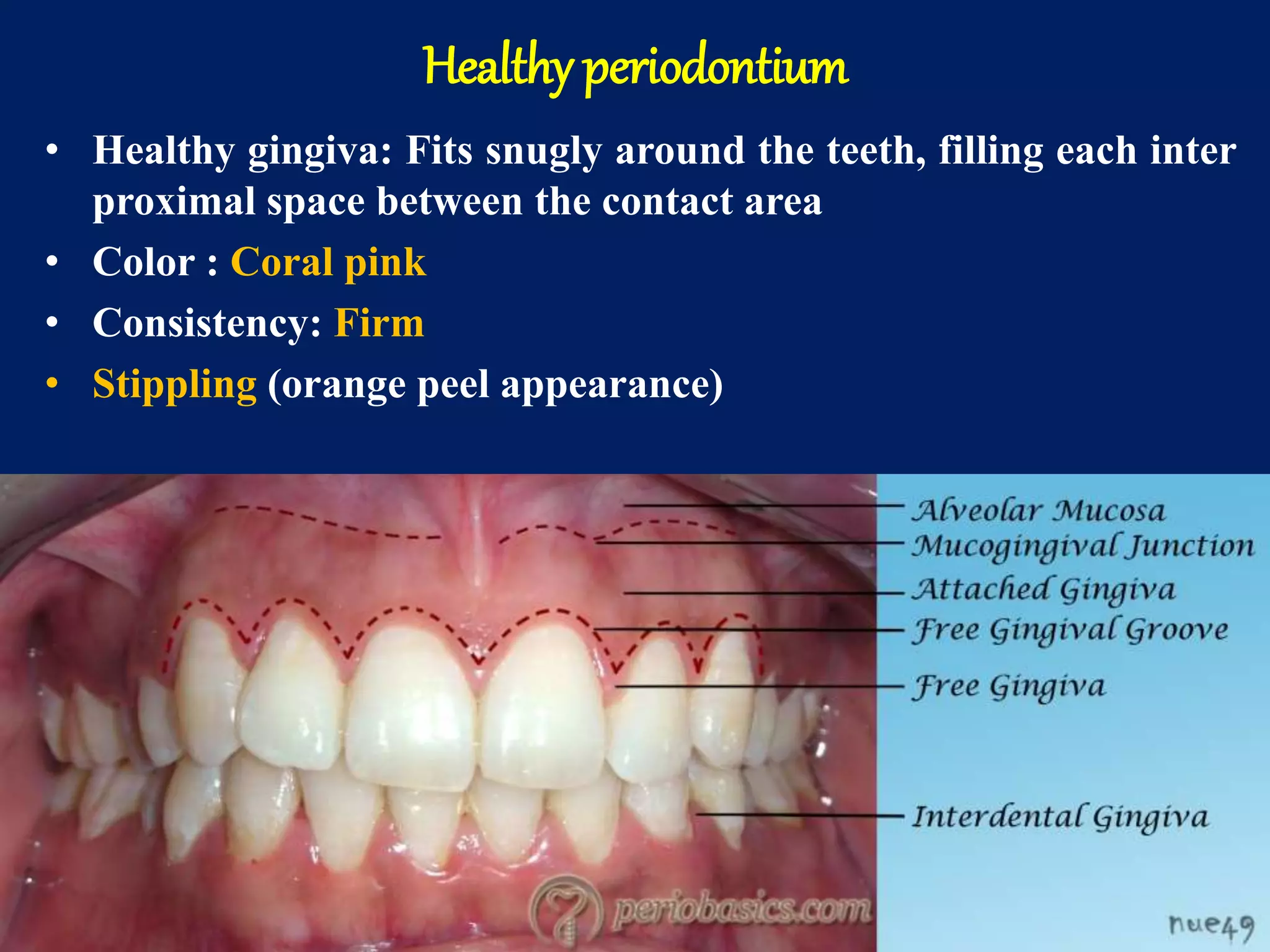 Periodontal diseases ppt | PPTX