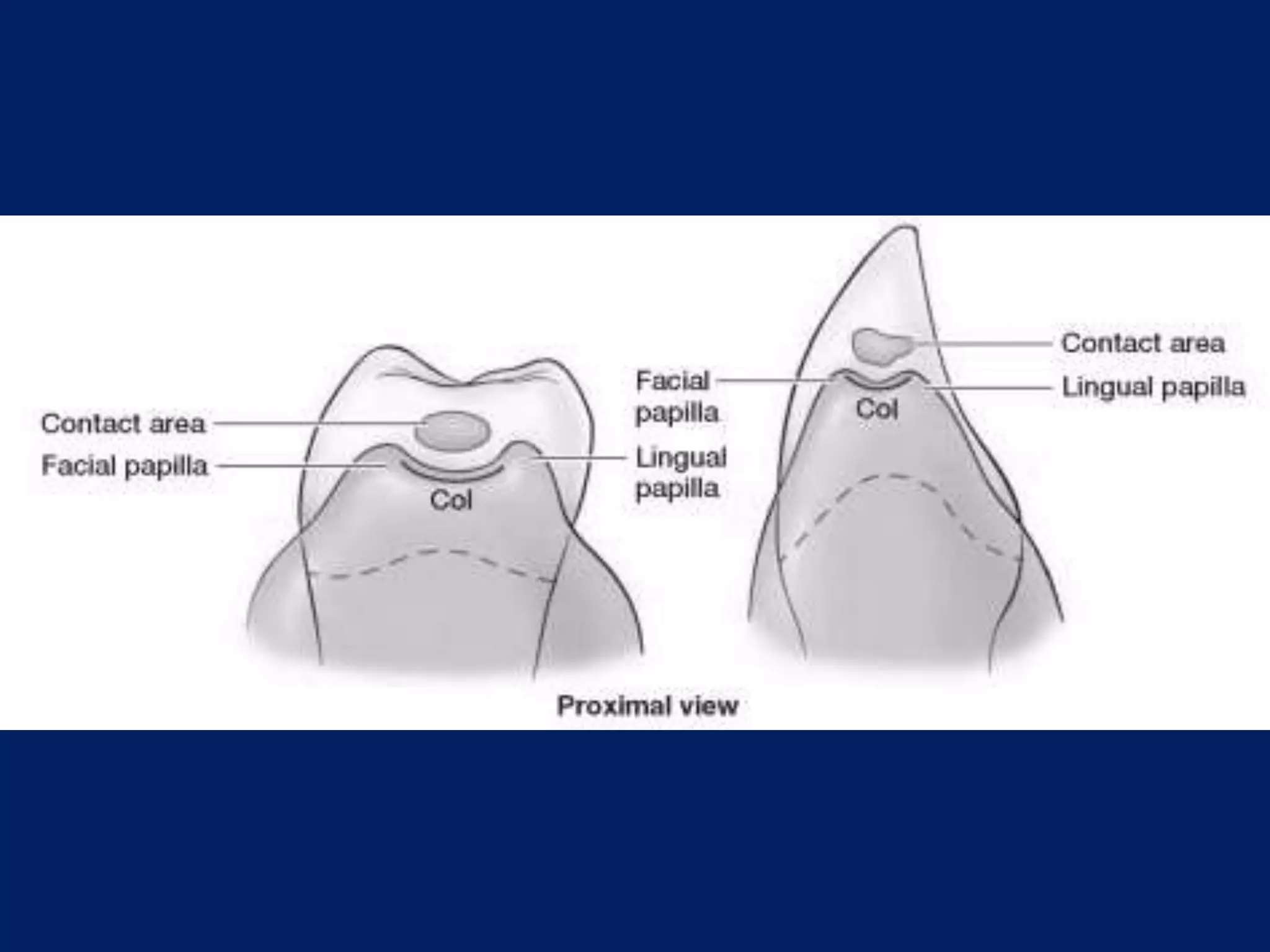 Periodontal diseases ppt | PPTX