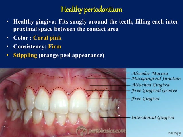 Periodontal diseases ppt | PPTX
