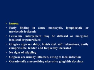 Periodontal diseases ppt | PPTX