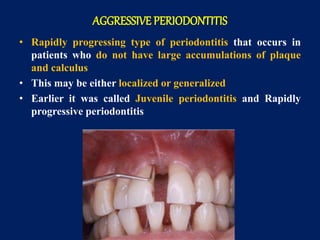 Periodontal diseases ppt | PPTX