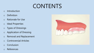 PERIODONTAL DRESSING perio pack - JC.pptx | Oral care | Personal Care