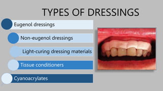PERIODONTAL DRESSING perio pack - JC.pptx | Oral care | Personal Care