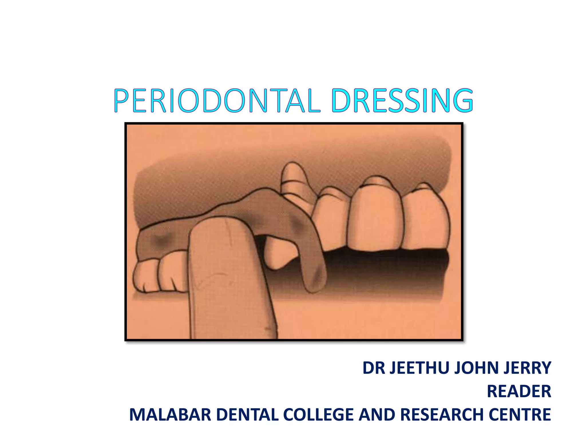 Periodontal dressings | PPTX