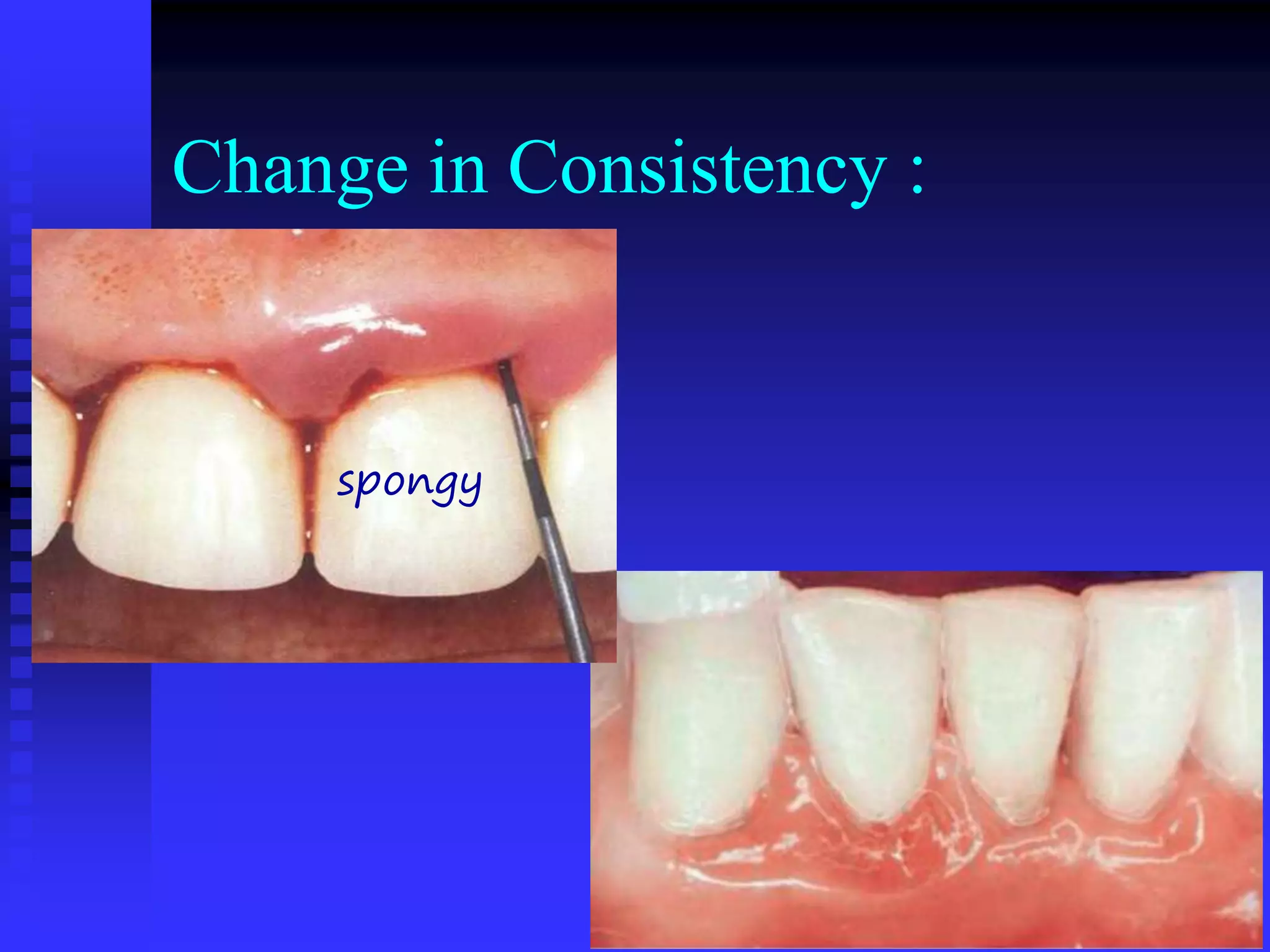 Periodontal Examination Chart Ppt Pdf