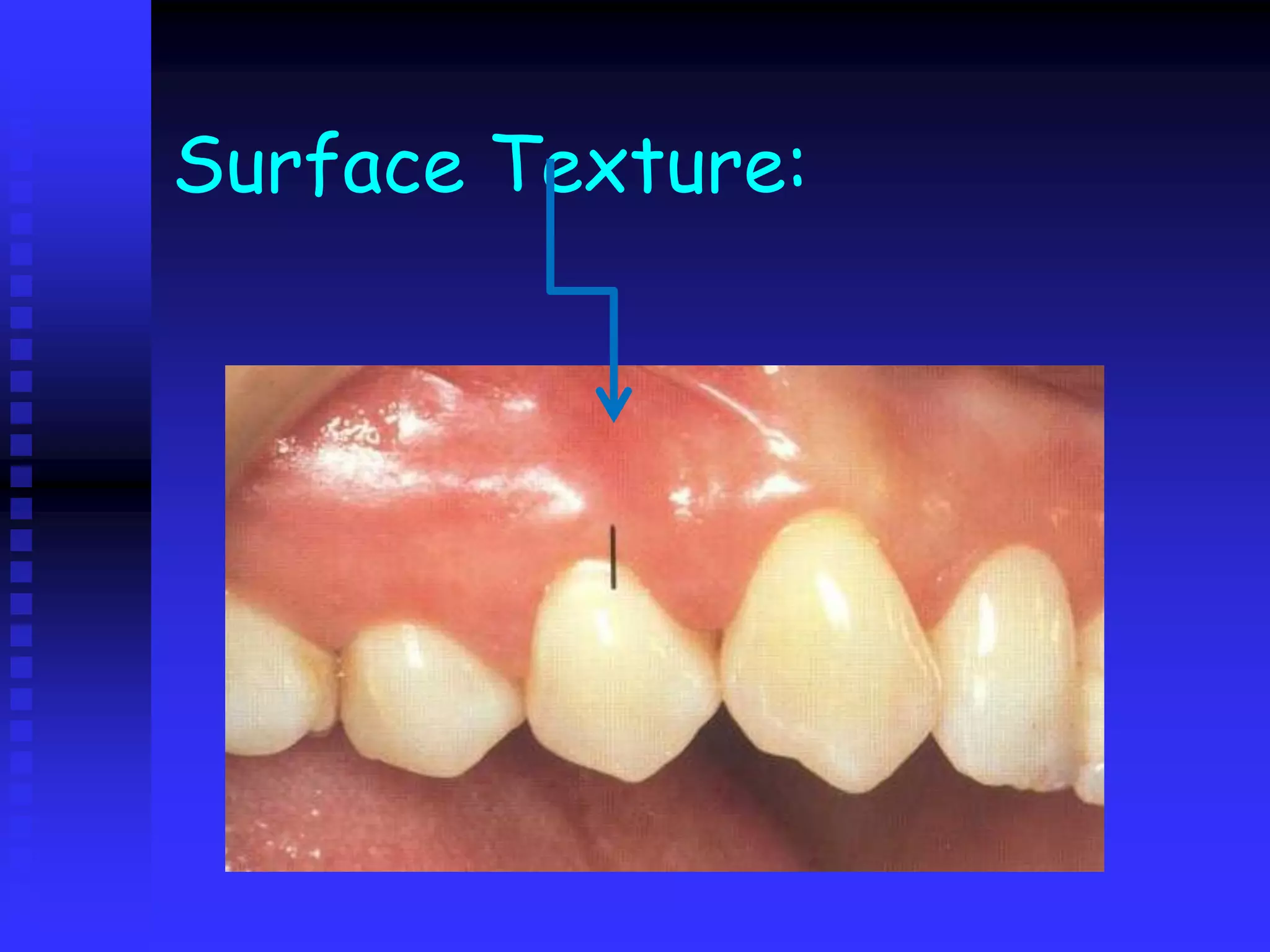 Periodontal examination ,chart. ppt | PDF