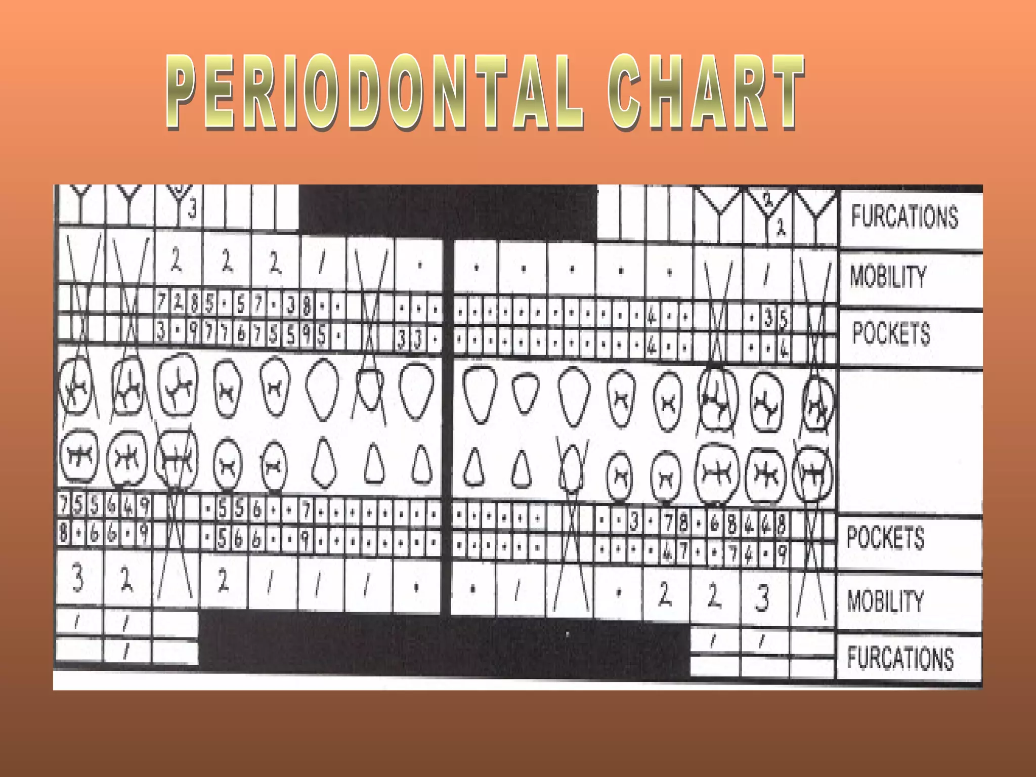 Periodontal examintation,diagnosis and prognosis | PPT