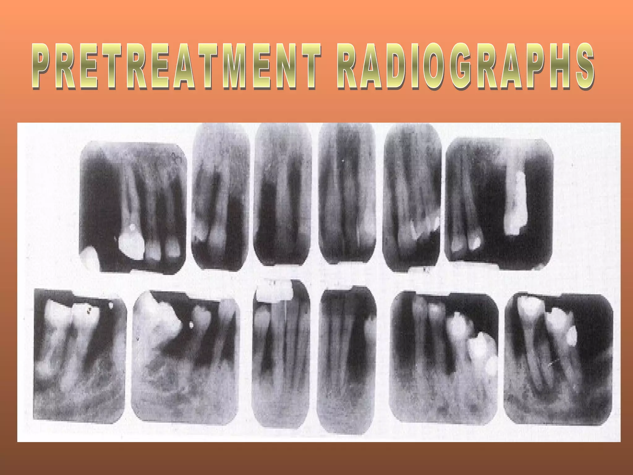 Periodontal examintation,diagnosis and prognosis | PPT