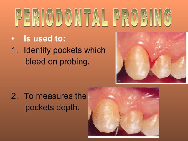 Periodontal examintation,diagnosis and prognosis | PPT