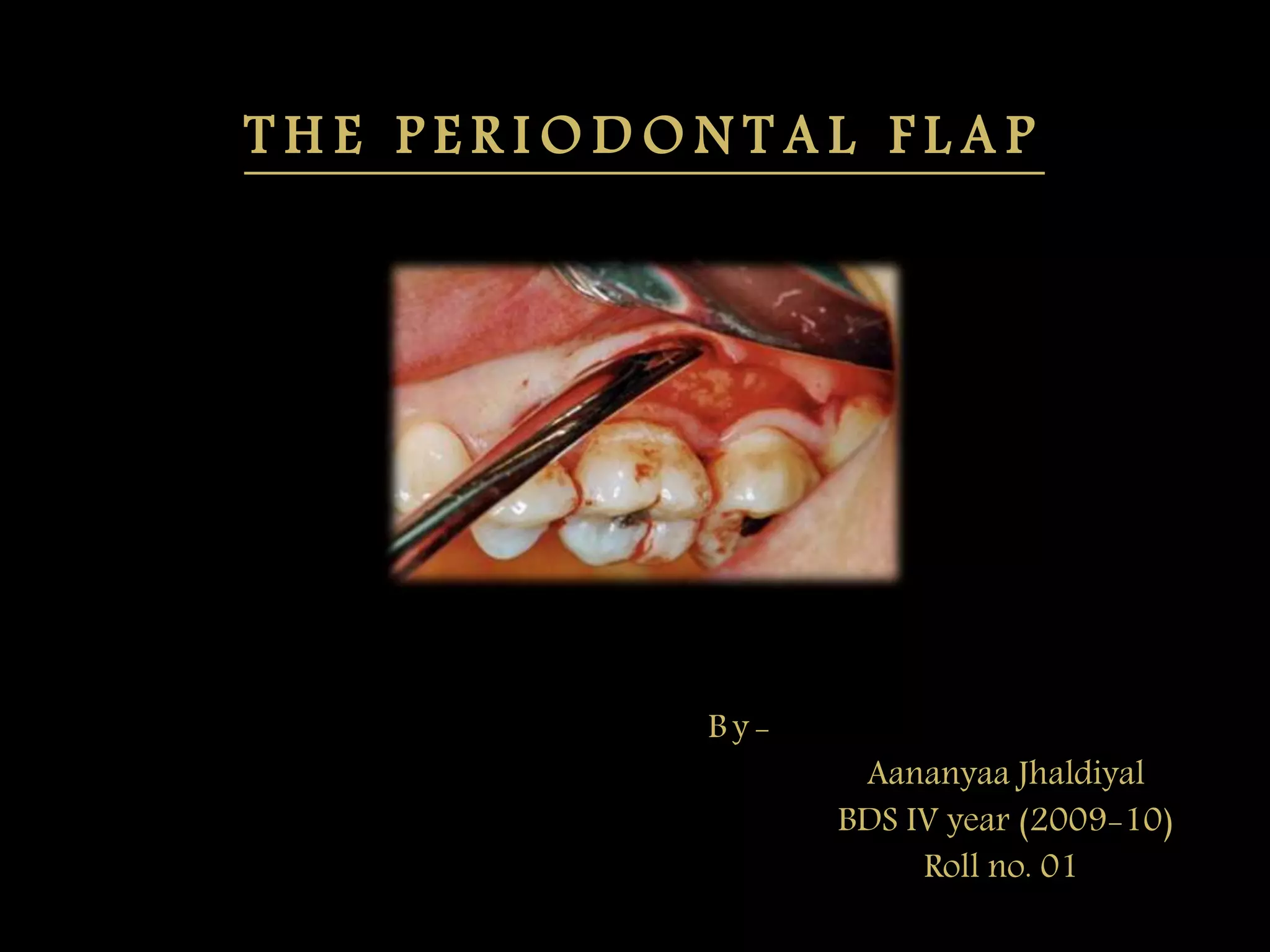The Periodontal flap | PPTX