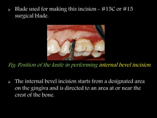 The Periodontal flap | PPTX