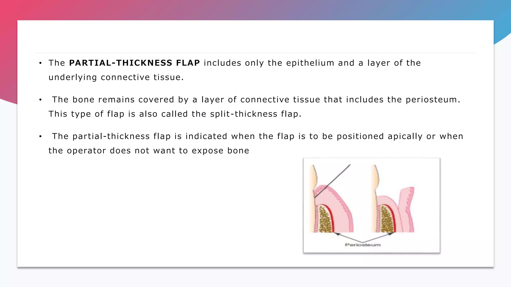Periodontal flap design for access on osseous surgery | PPTX