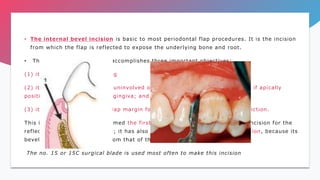 Periodontal flap design for access on osseous surgery | PPTX