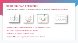 Periodontal flap design for access on osseous surgery | PPTX