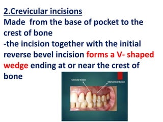 Periodontal flaps | PPTX
