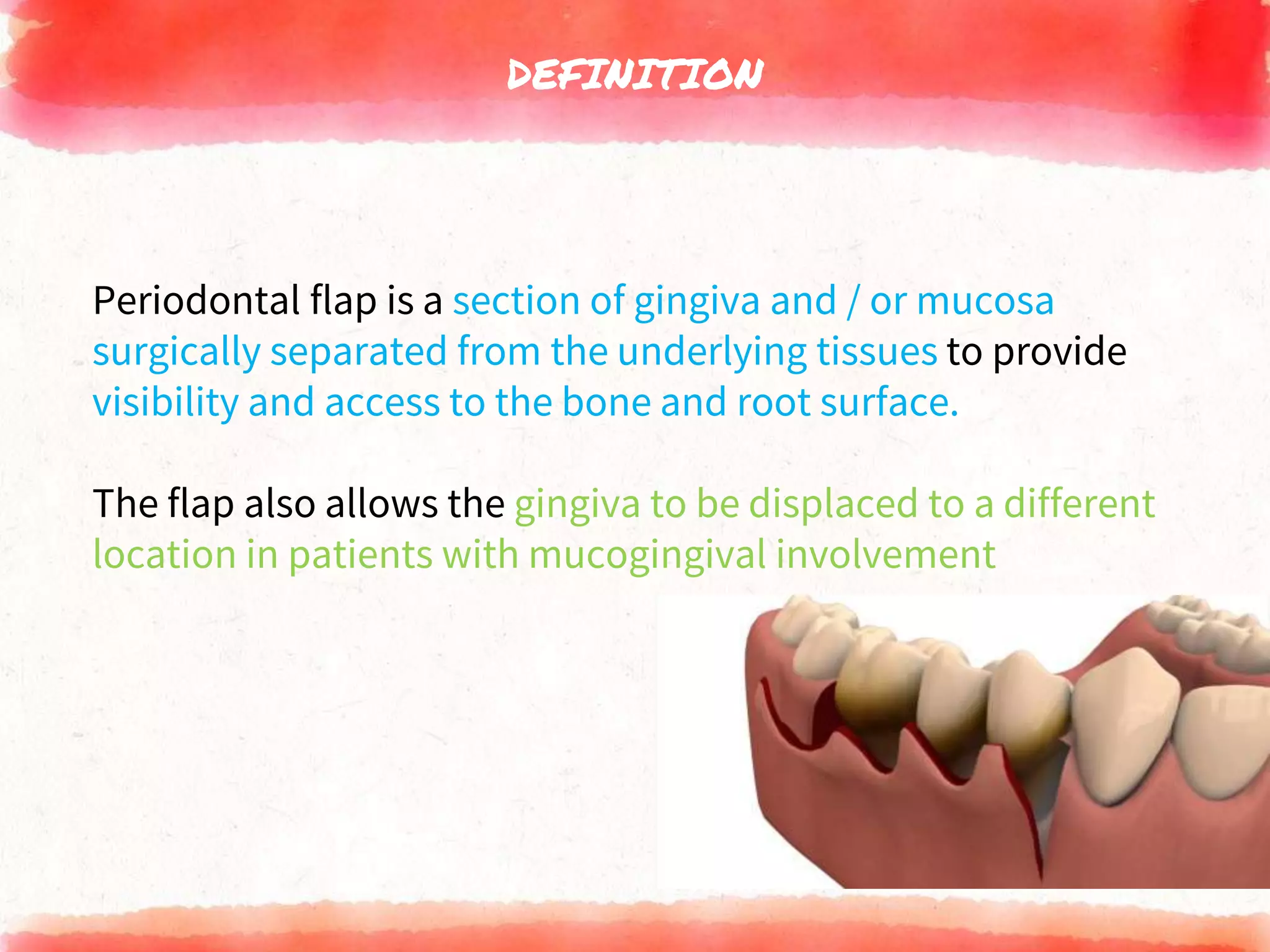 Periodontal flap surgery | PPTX