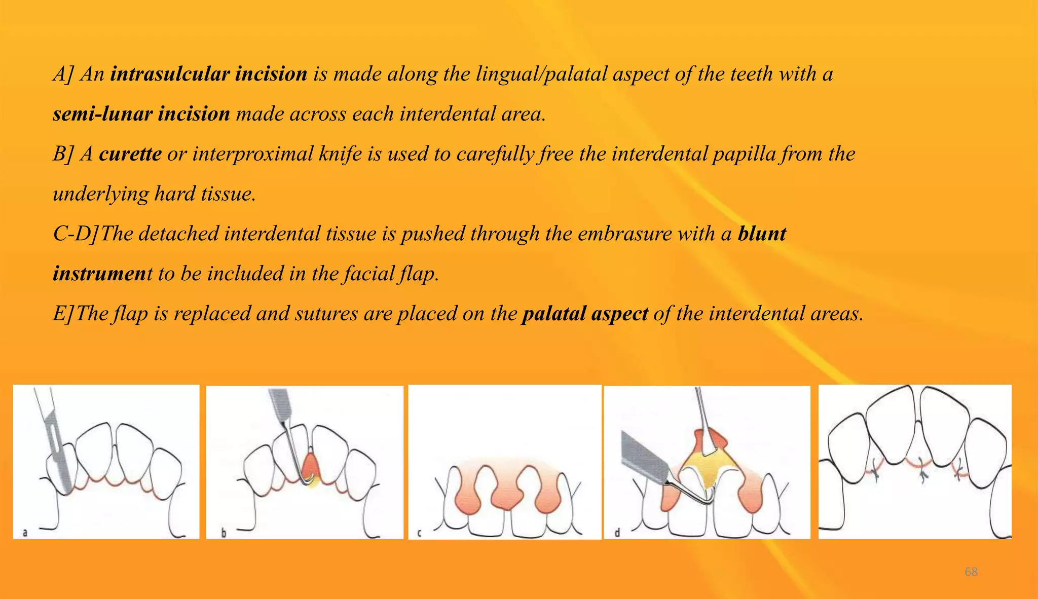 Periodontal flap surgery | PPTX