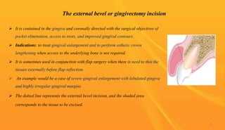 Periodontal flap surgery | PPTX