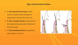 Periodontal flap surgery | PPTX