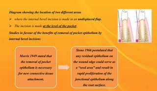 Periodontal flap surgery | PPTX