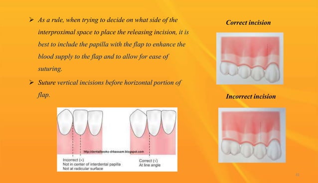 Periodontal flap surgery | PPTX