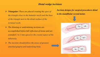 Periodontal flap surgery | PPTX