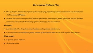 Periodontal flap surgery | PPTX