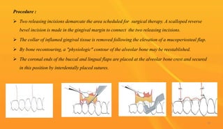 Periodontal flap surgery | PPTX