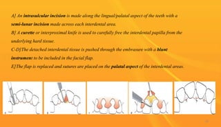 Periodontal flap surgery | PPTX