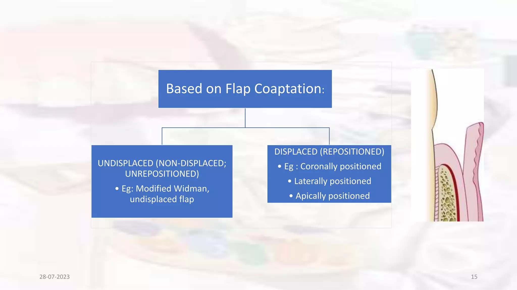 periodontal flap surgery | PPTX
