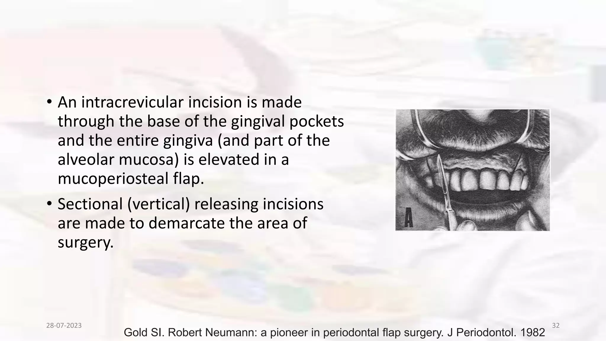 periodontal flap surgery | PPTX