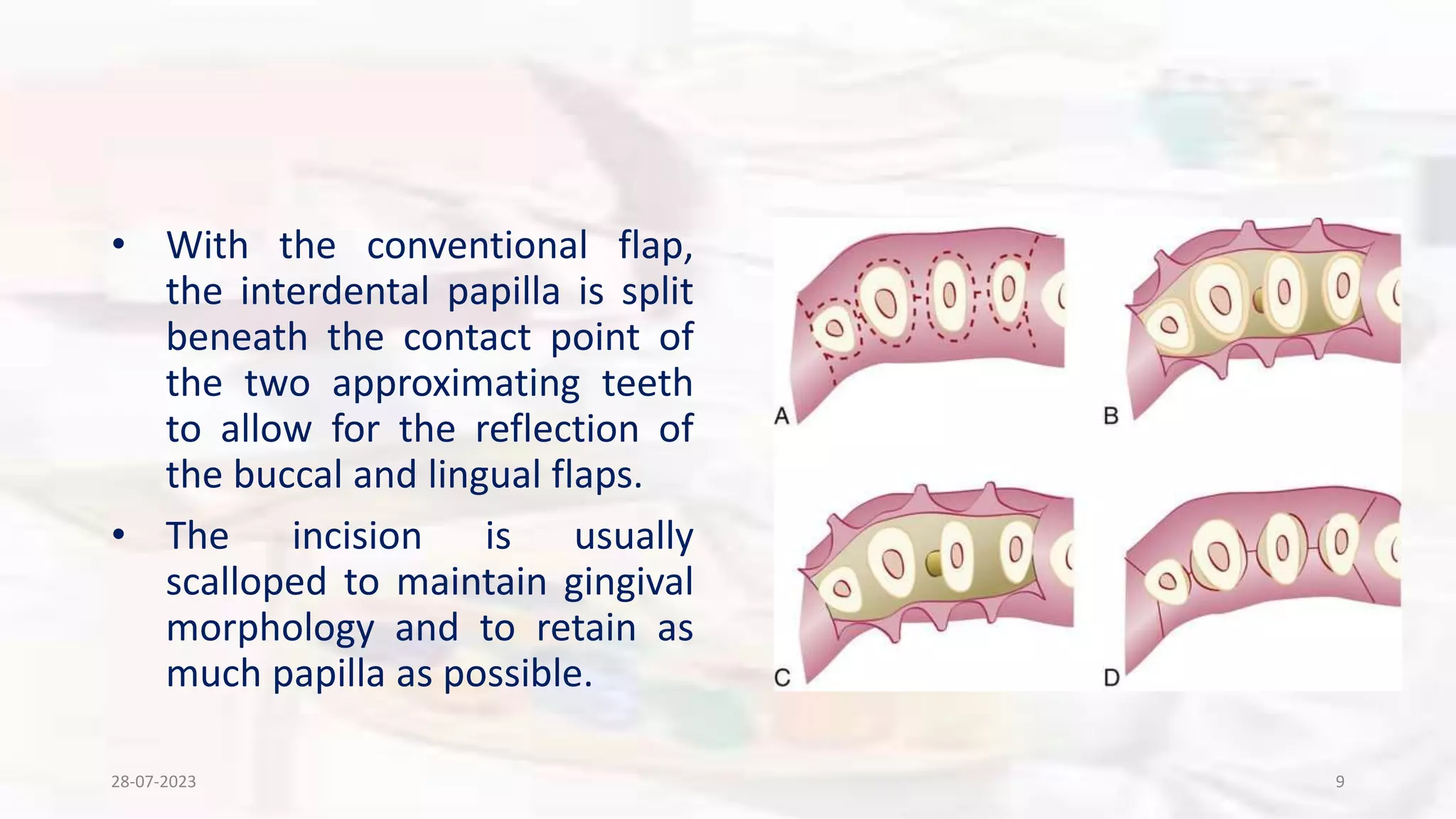 periodontal flap surgery | PPTX
