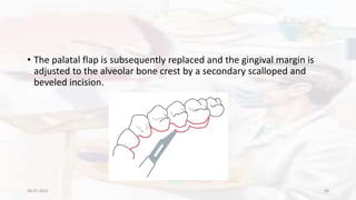 periodontal flap surgery | PPTX