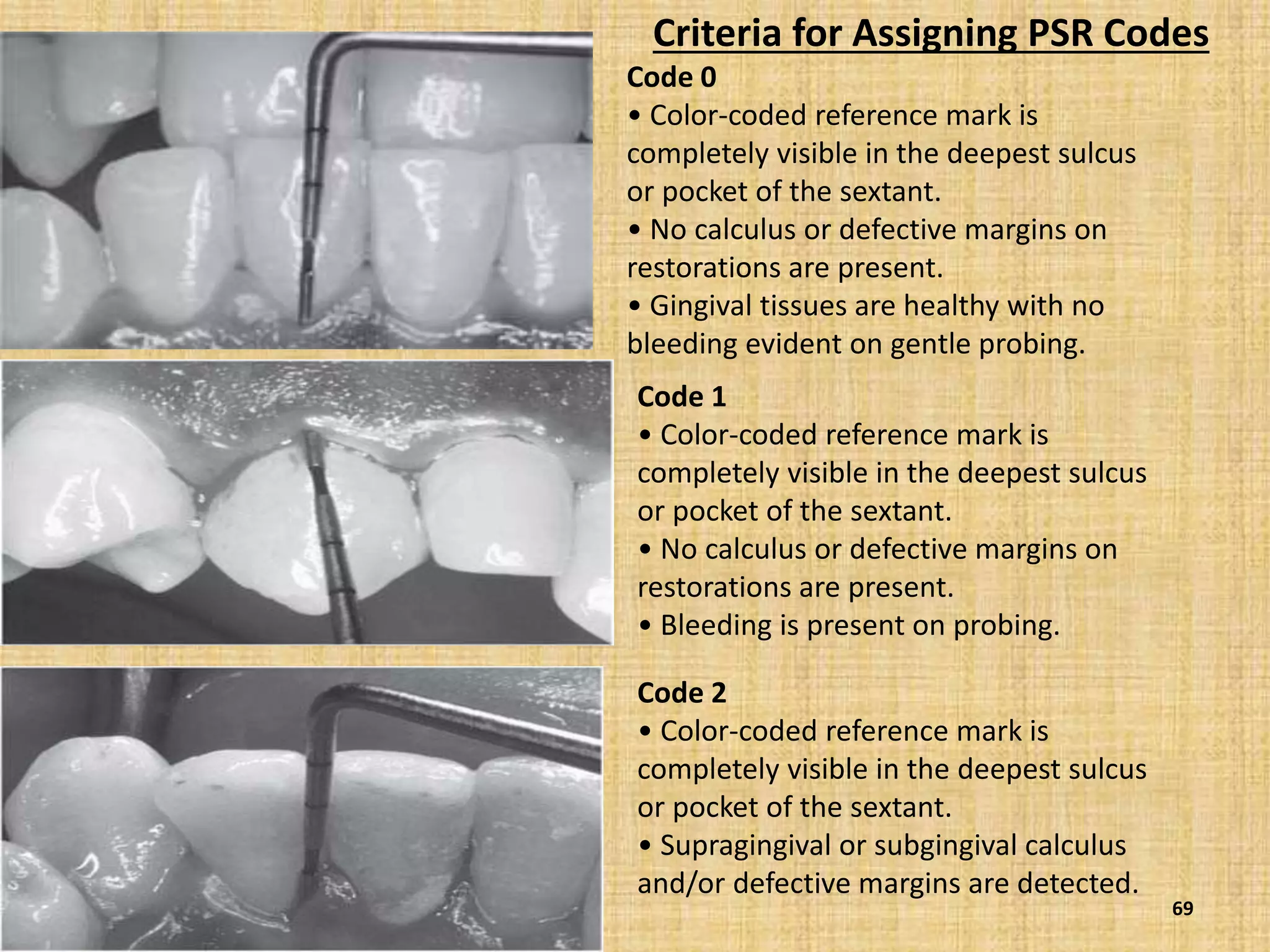 Periodontal Indices by Dr. Neelam Das .pptx