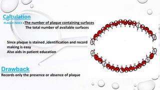 Periodontal indices final | PPTX