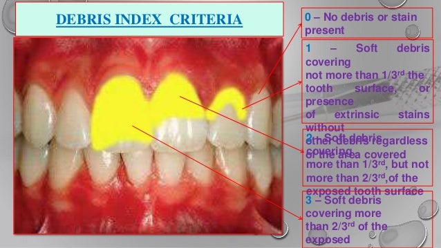 Periodontal indices final