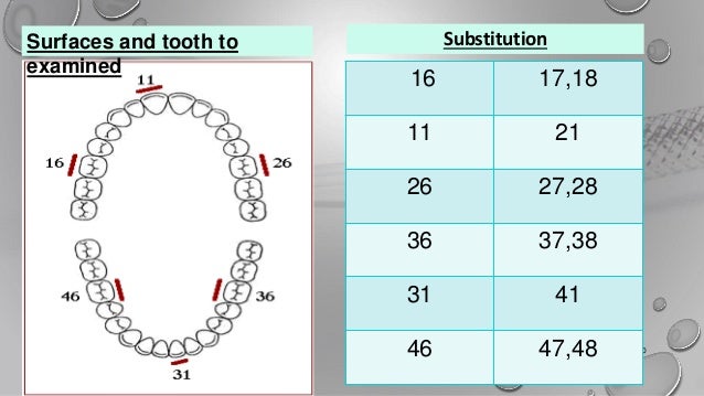 Periodontal indices final