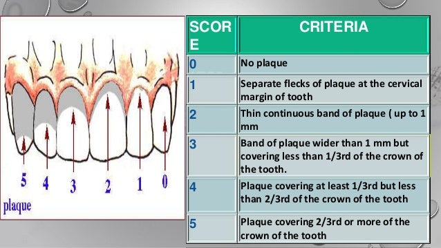 Periodontal indices final