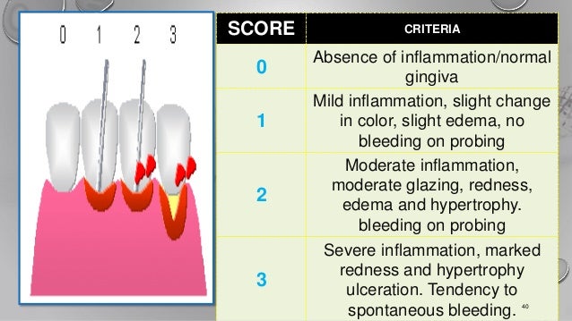 Periodontal indices final