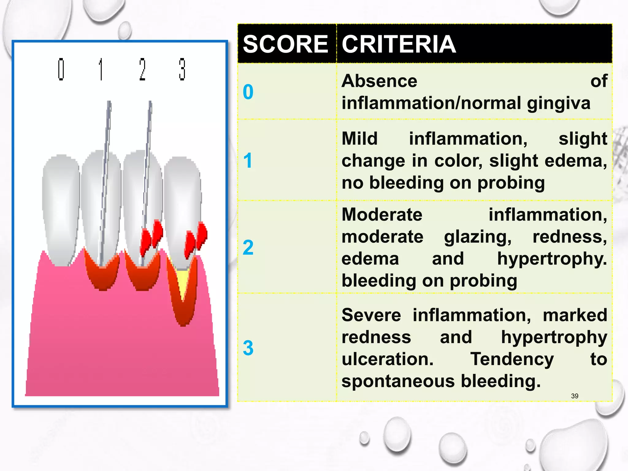 Periodontal indices final | PPTX