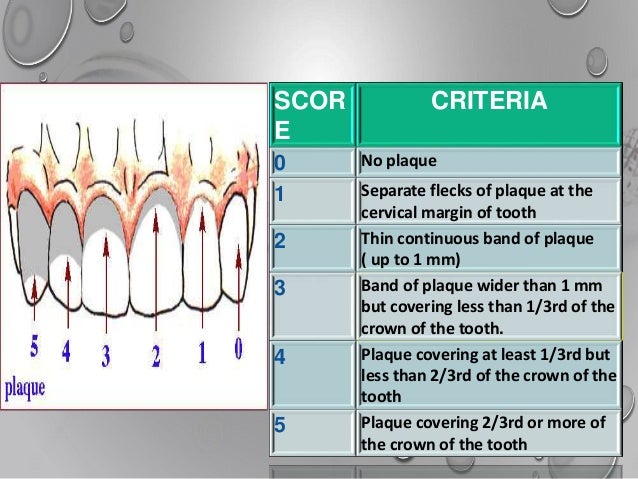 Periodontal indices final
