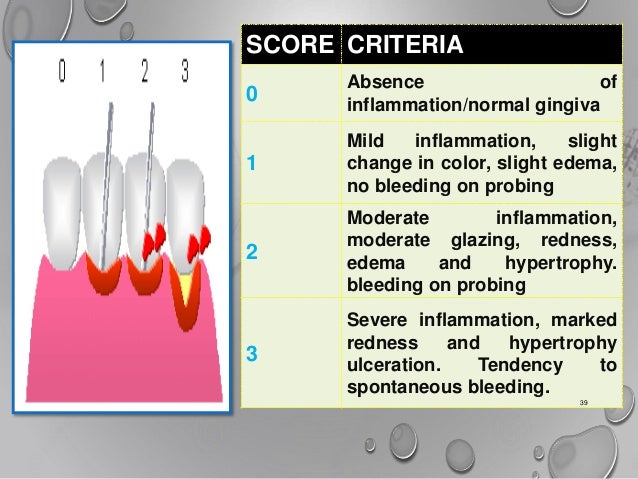 Periodontal indices final