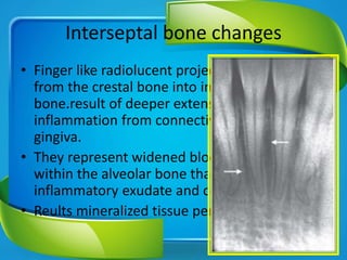 Interseptal Bone
