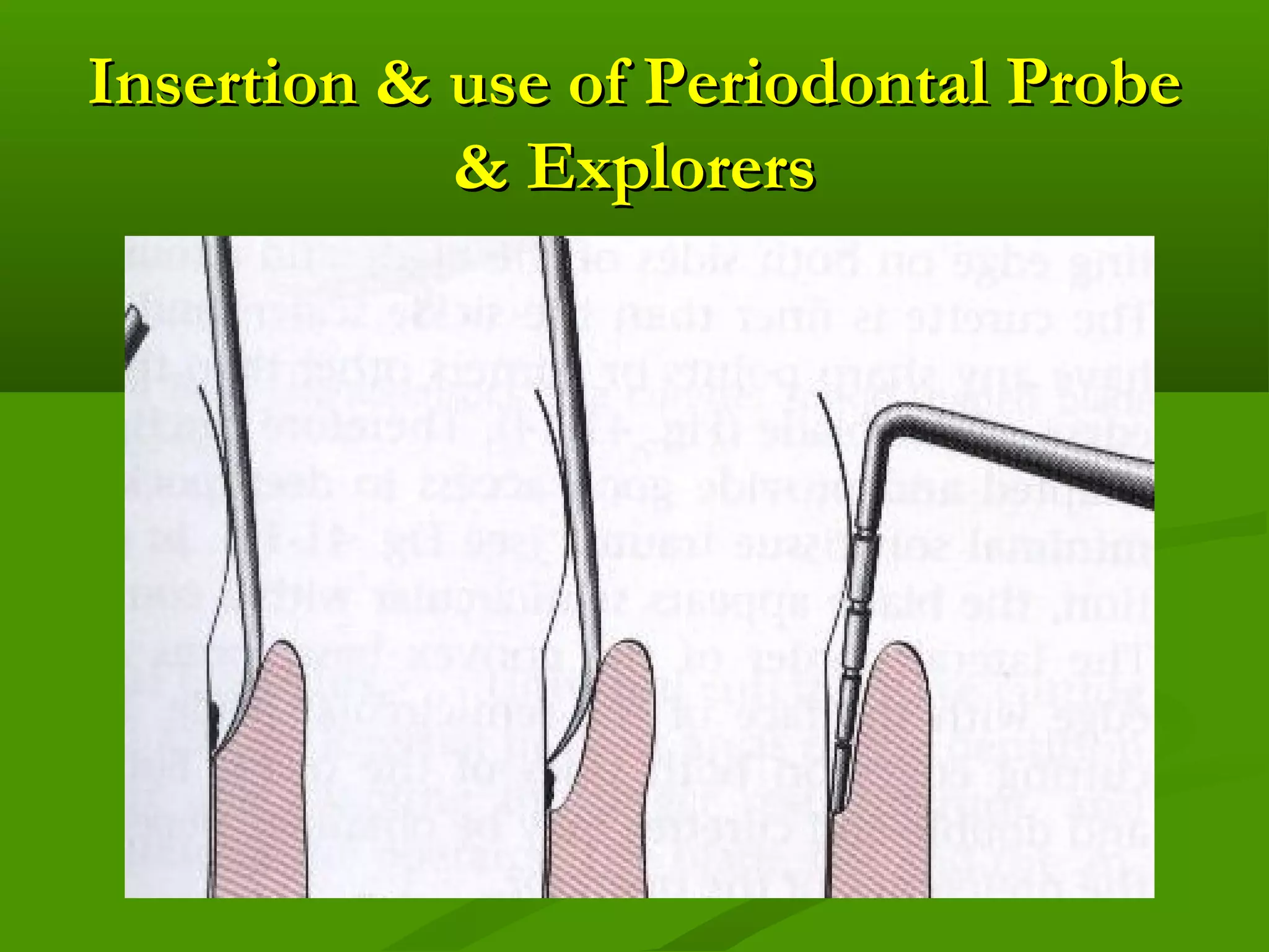 Periodontal instrumentation | PPT