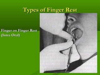 Periodontal instrumentation | PPT