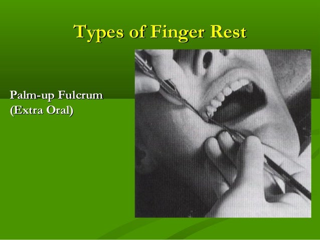 Periodontal instrumentation