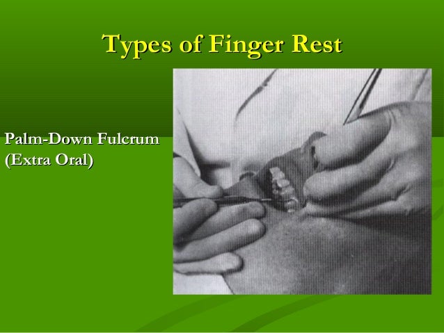 Periodontal instrumentation