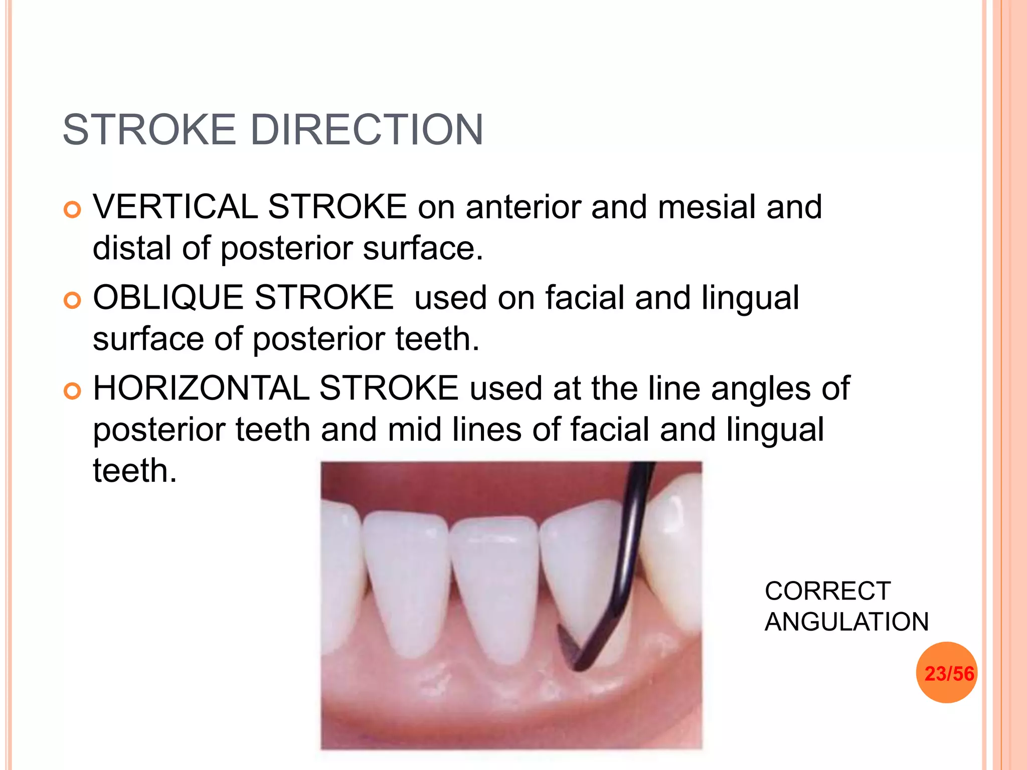 Periodontal instruments | PPTX